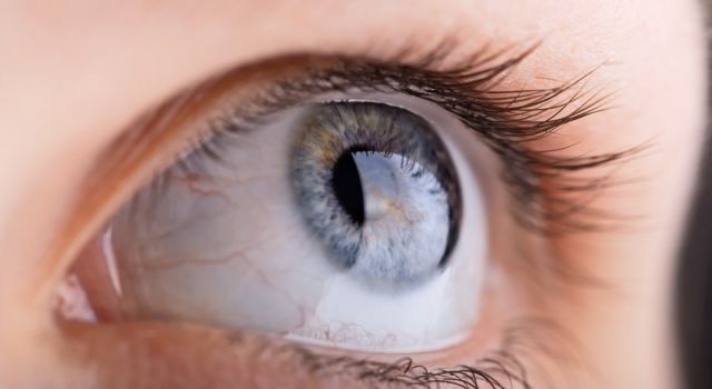 Corneal Abrasion, Scratched Cornea, Scratched Eye, Symptoms and ...