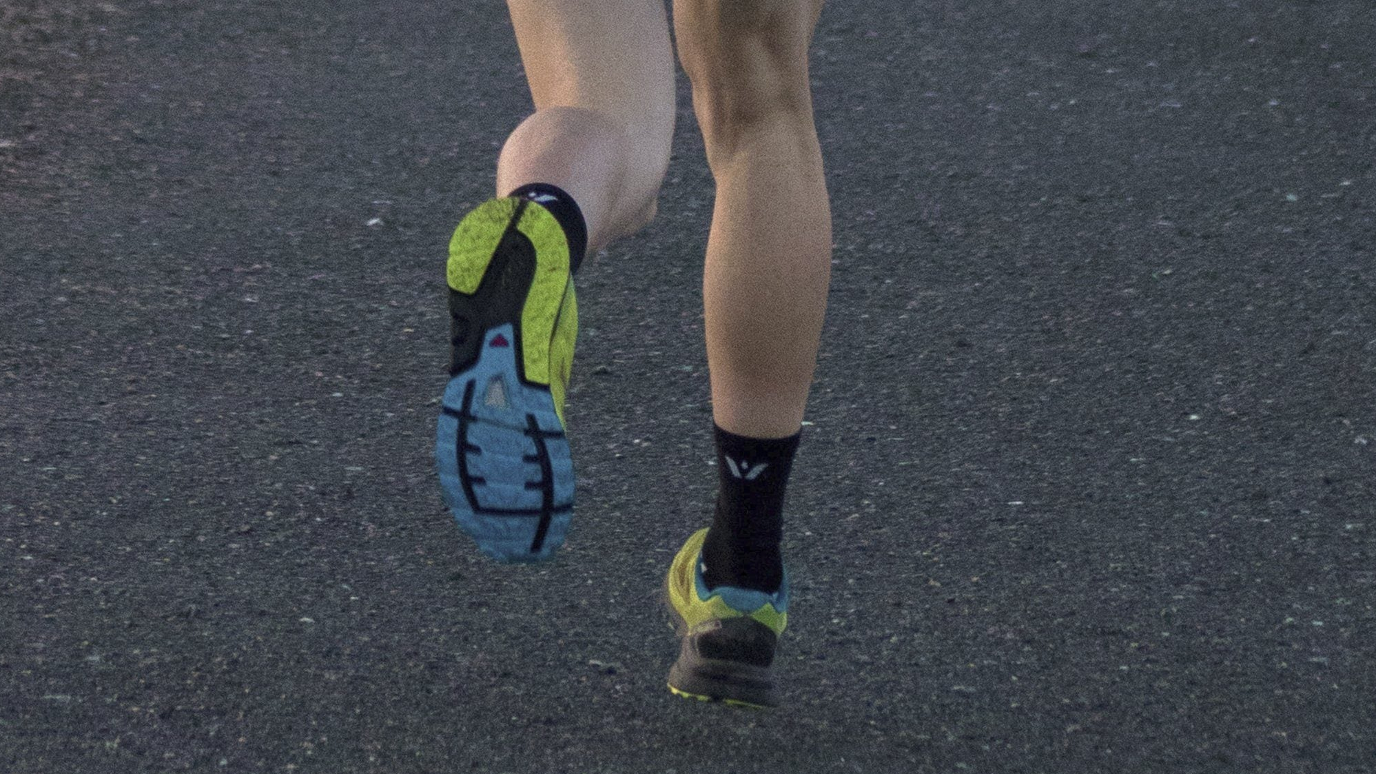 Do You Suffer from Excess Supination? Here’s How to Fix It – General ...