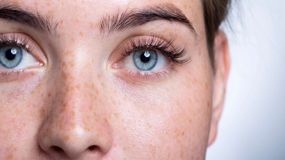 Which Fruits to Eat for Eye Health? – General Health Magazine